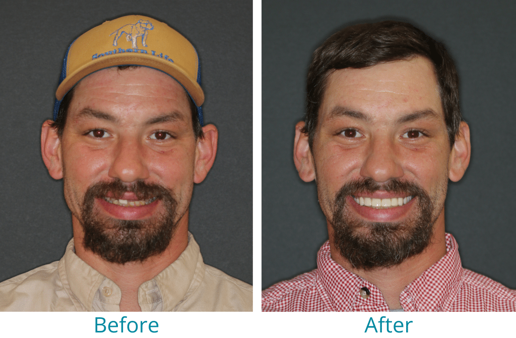 Rusty's Stunning Smile Makeover